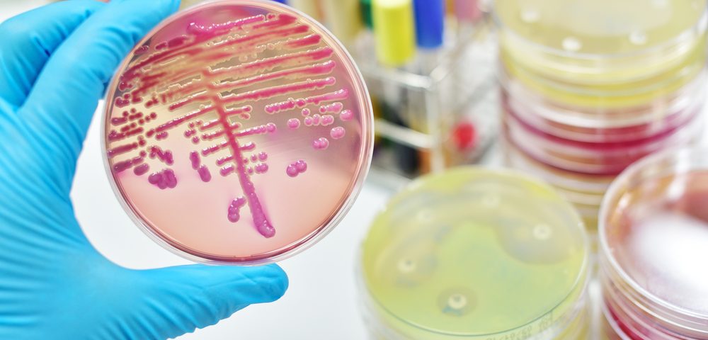 Omadacycline Shows Punch Against Drug Resistant Bacteria Studies Pneumonia Research News